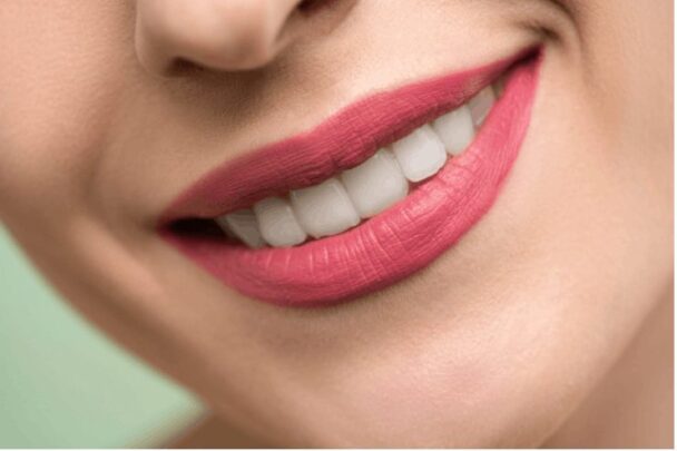 Dental Braces Costs In Japan 2026 - My Guide as an Expat – Japan Truly